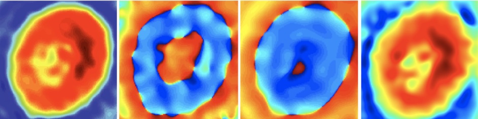 Deconvolved phase imaging for diffraction tomography | Phi - X